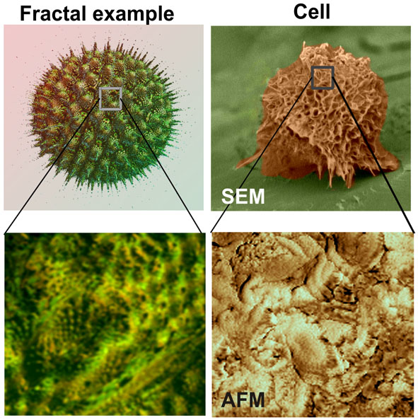 Cancer Cell Vs Normal Cell Microscope