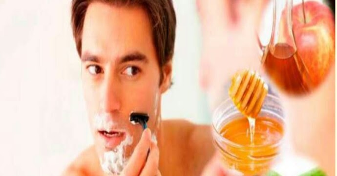 HOW TO GET RID OF RAZOR BURN