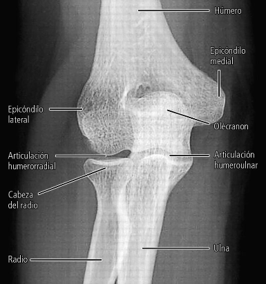 MMII-RX PIE DORSO Y PERFIL, AMBOS PIE