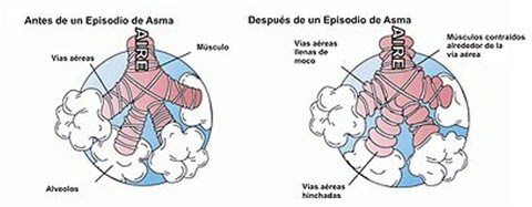 Ceamse y sus consecuencias