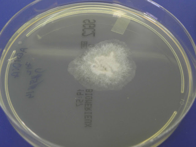 ATLAS MICOLOGIA: ABSIDIA CORYMBIFERA / Lichtheimia corymbifera