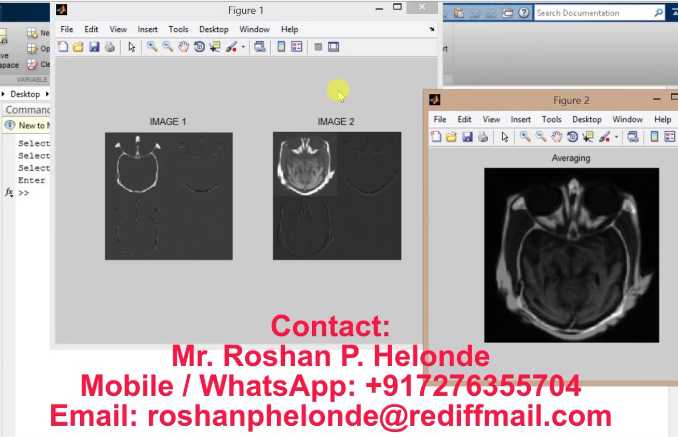 Matlab code for Image Fusion using Wavelet Transform ~ Matlab Project Codes