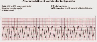 ENFERMERÍA - NURSING: SUDDEN COLLAPSE AND CARDIAC ARREST