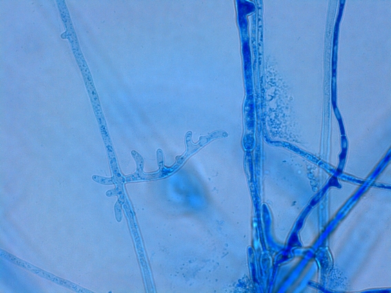 Fun With Microbiology (What's Buggin' You?): Microsporum audouinii