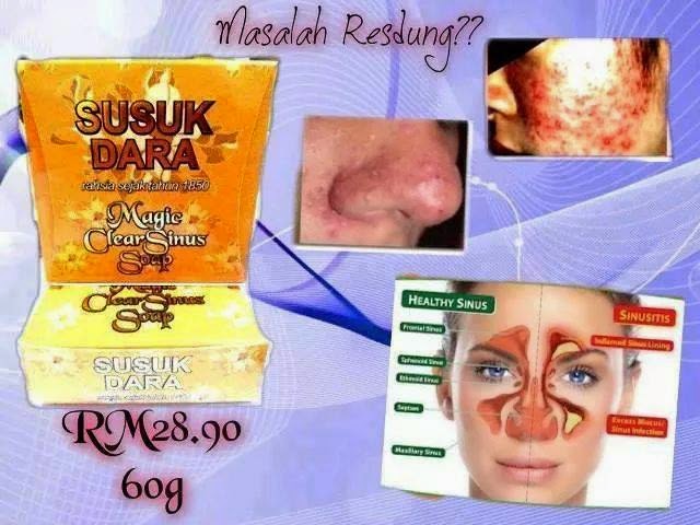 JAMU SUSUK DARA: RESDUNG DAN RAWATANNYA