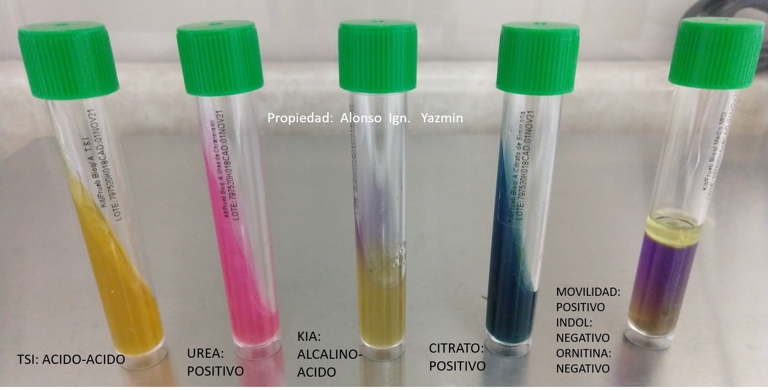 Bioquímica Diagnóstica BQD-YAI: Pseudomonas aeruginosa