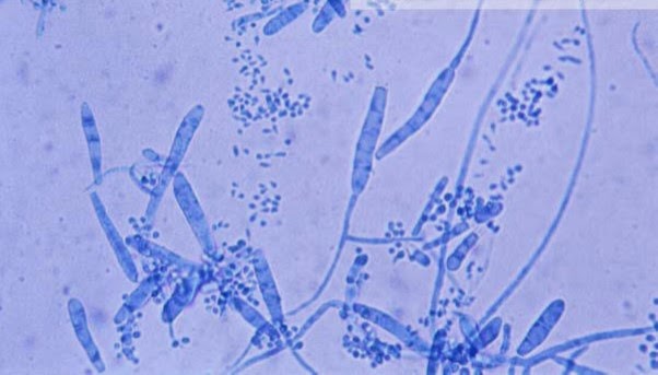 Micología Diagnostica: Dermatofitos. Género Trichophyton spp.