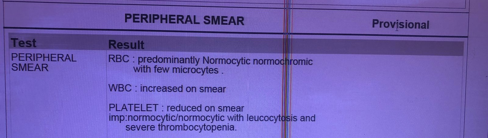 40 YEAR FEMALE WITH VIRAL PYREXIA WITH THROMBOCYTOPENIA