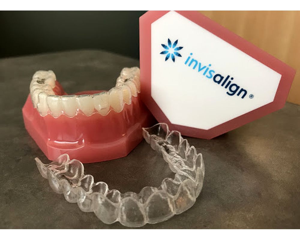 ¿Cuáles son las ventajas del Invisalign? - Ortodoncia Invisible ...