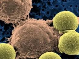 PASANDO PAGINA: ¿¿ que pasa en la muerte de celulas ??? Como se ...