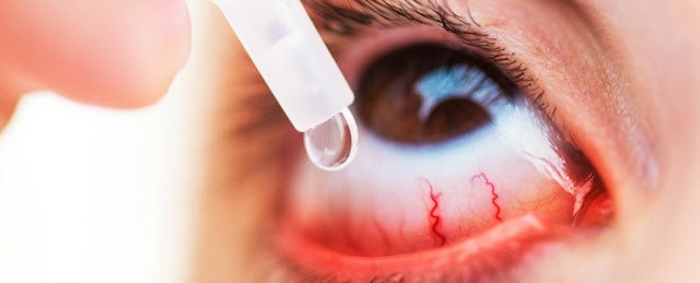 EYE & VISION CARE - NATURAL HEALTH SOLUTIONS