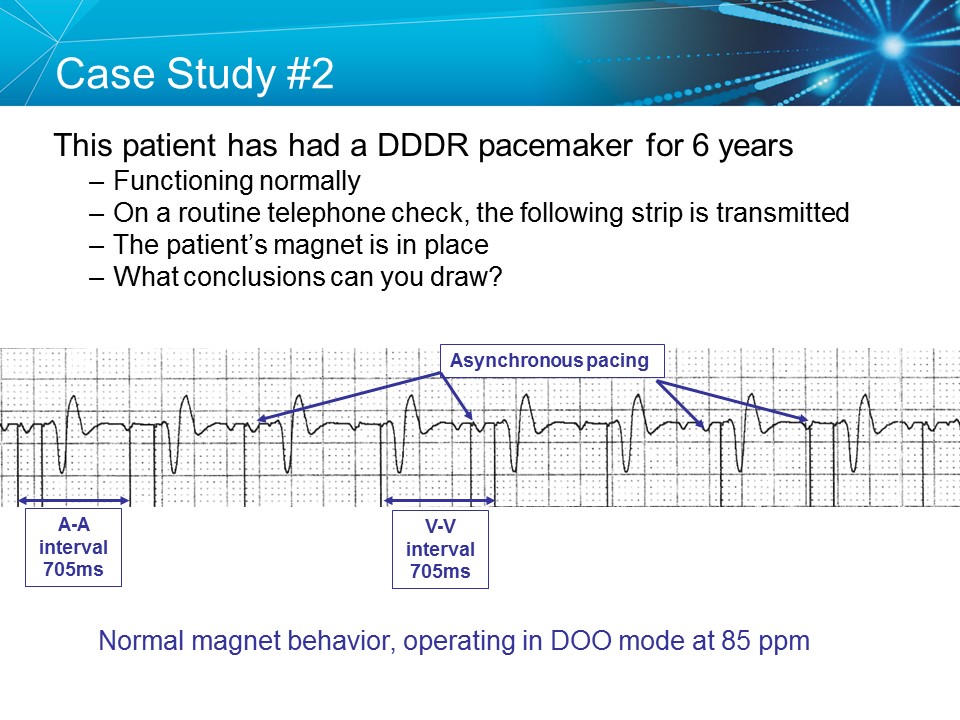 CVT Mohd Farid: Pacemaker Follow Up Part II-Medtronic Academy