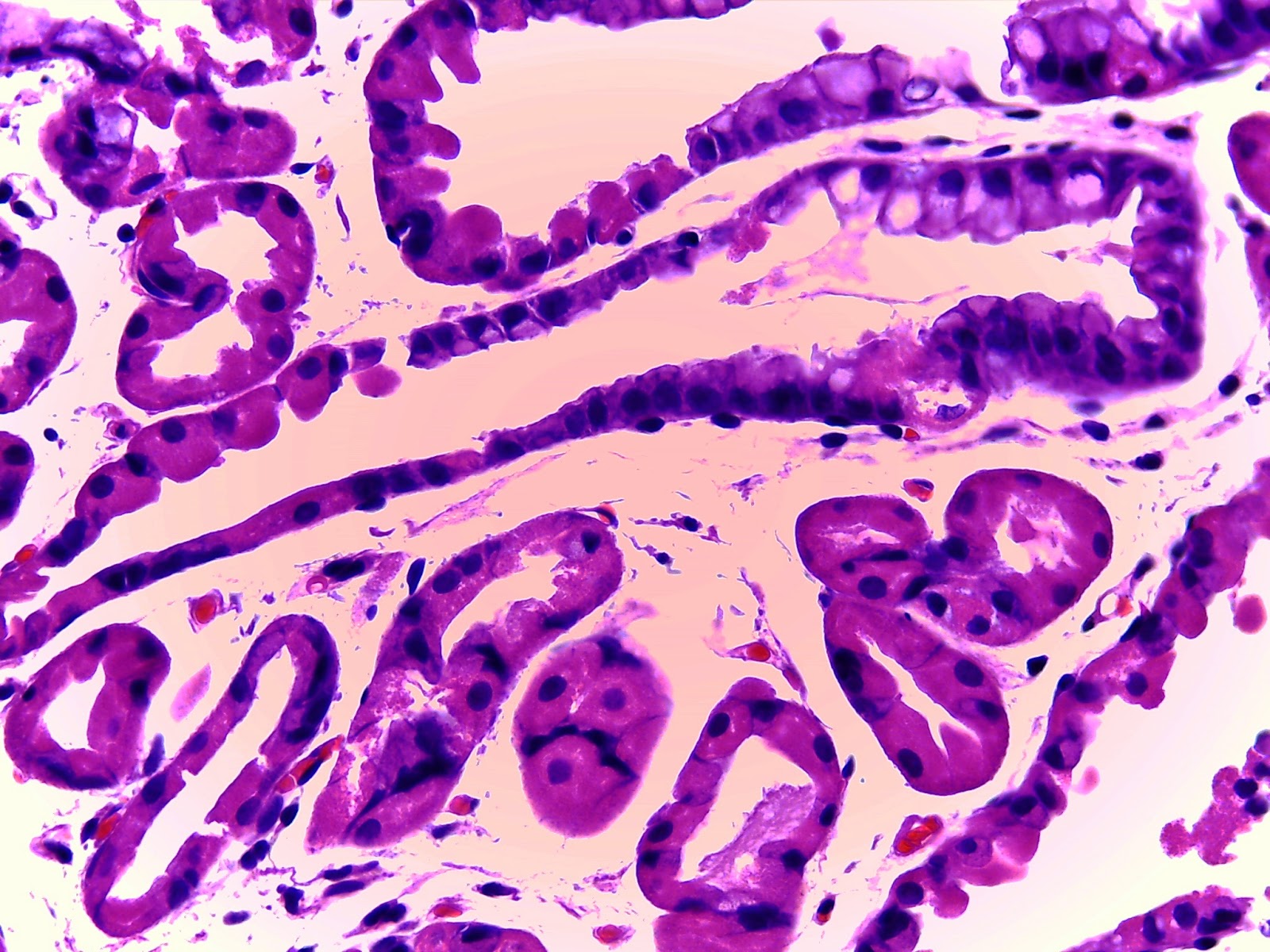 GASTROINTESTINAL AND LIVER HISTOLOGY PATHOLOGY ATLAS: STOMACH: FUNDIC ...