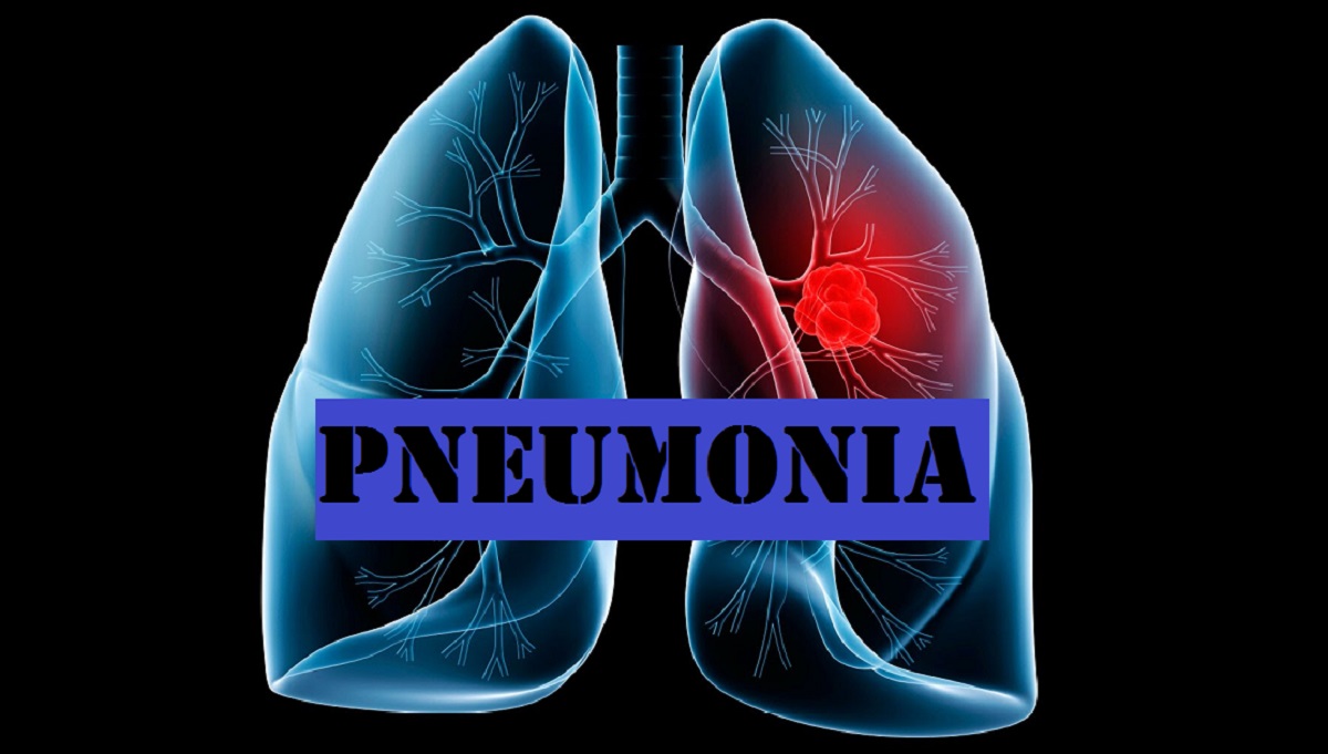 what is pneumonia what is pneumonia