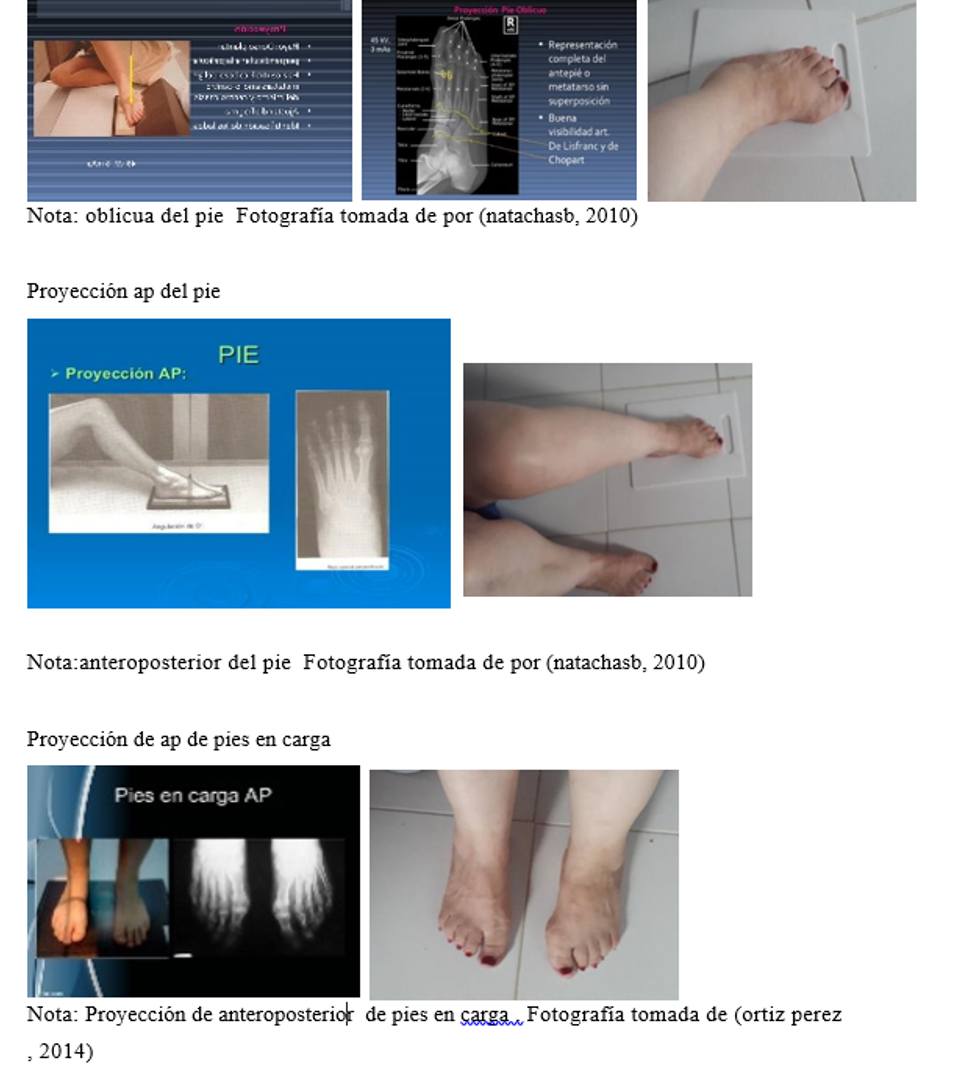 CREACION DE PROTOCOLOS : ESTUDIOS RADIOGRAFICOS MIEMBROS INFERIORES