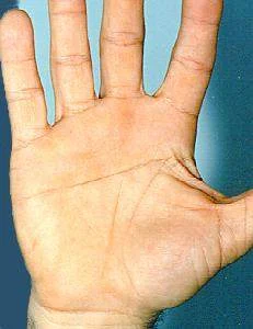 Importance Of Simian Line (Fused Line) In Indian Palmistry ~ INDIAN ...