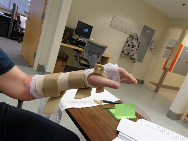 Here's Your Gold Watch - Rheutired: Wrist Fusion Surgery