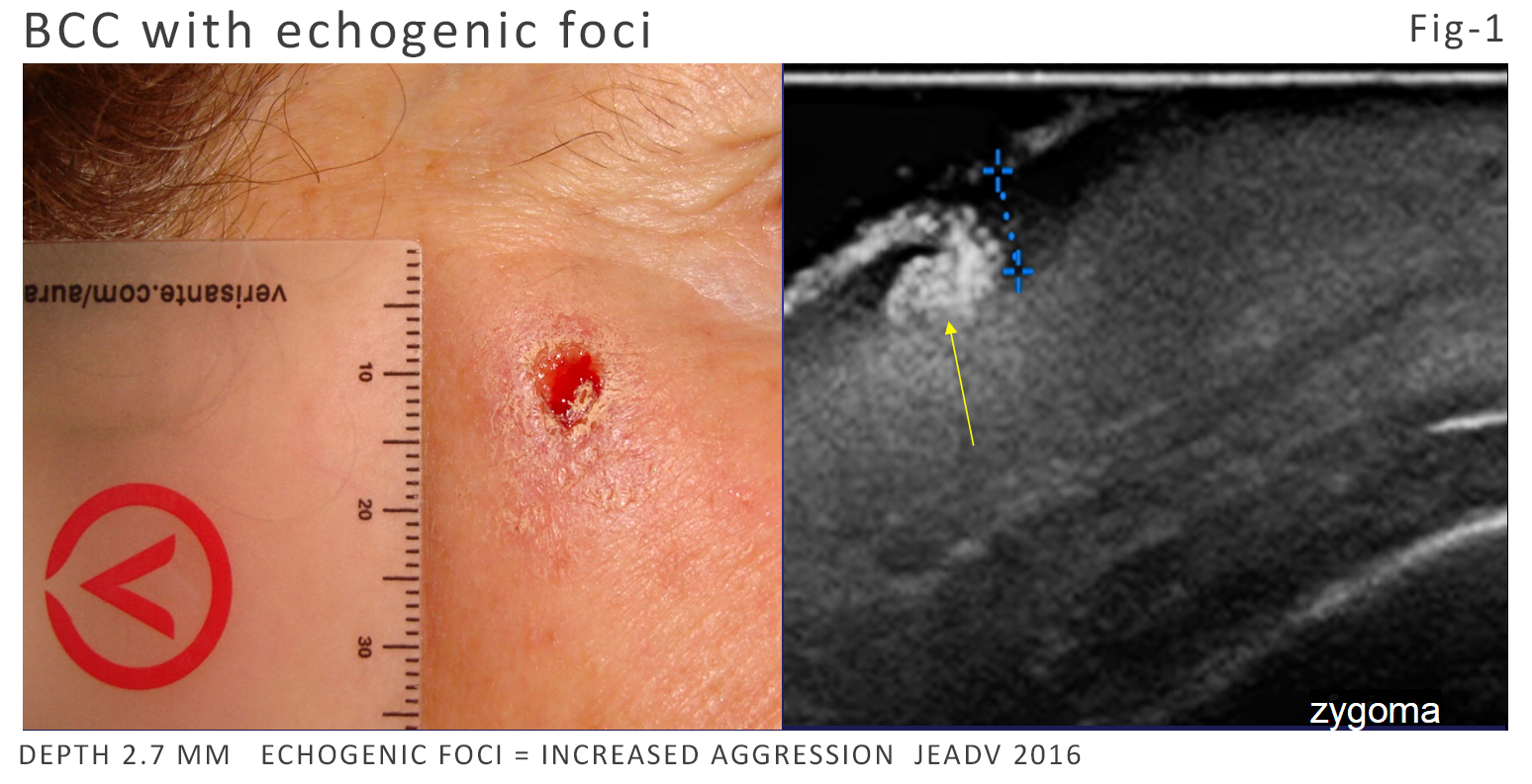Modern Diagnostic Science: "GOT METALS?" Research Project: Imaging ...