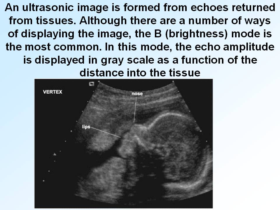 ektalks: Medical Imaging - Ultrasound Imaging; On the nature of sound waves
