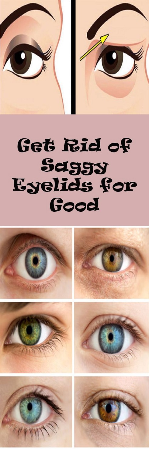 Natural Remedy For Sagging Eyelids You Will See Results In 2 Minutes ...