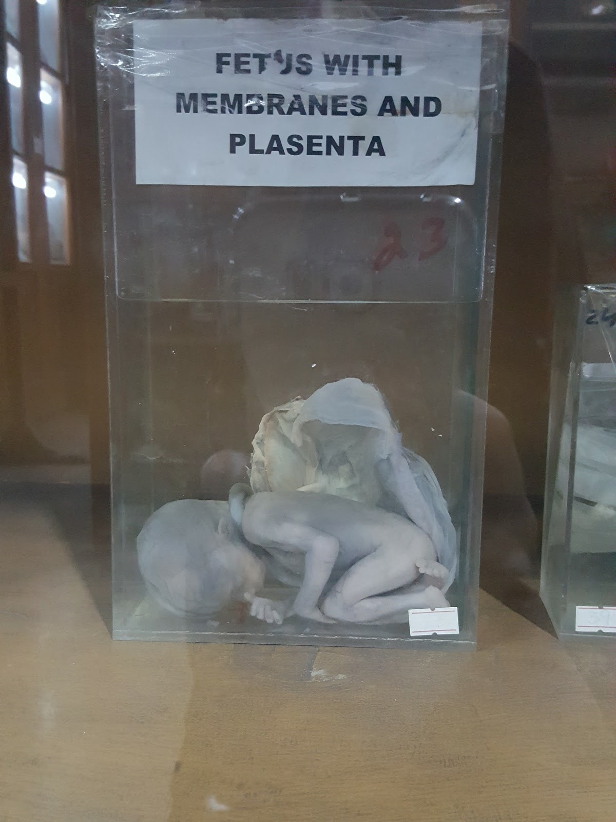 Forensic museum models and specimens (upadated 2016)