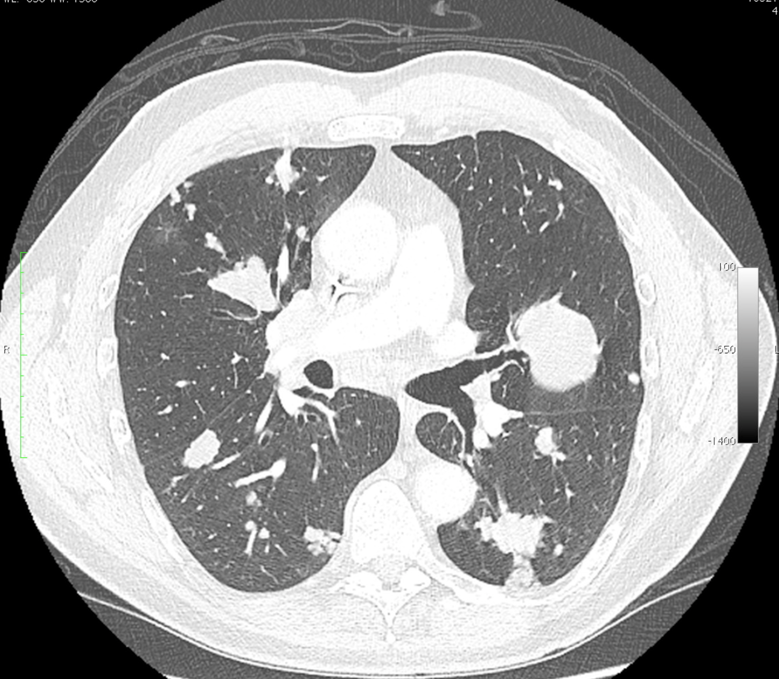 iTri4ACure: Who Needs Medical School? I Don't