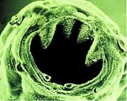 Ancilostomo o verme dentado - Gazeta Cebola