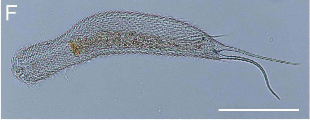 Catalogue of Organisms: Gastrotrichs and their Tacky Little Tubes