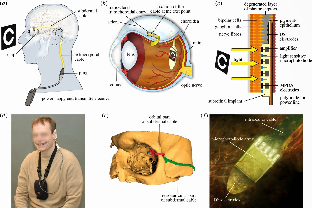 Bionic eyes and arms: March 2014