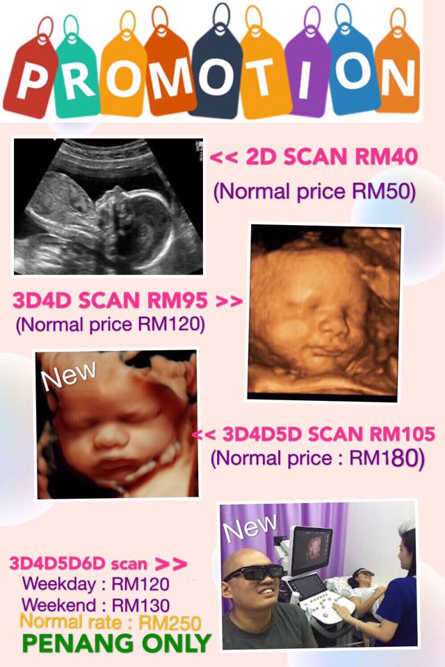 2D 3D 4D HD 5D scan ultrasound in MALAYSIA list : 2017