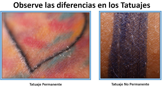 CRIMINALISTICA PANAMA: PERITAJE DE TATUAJES