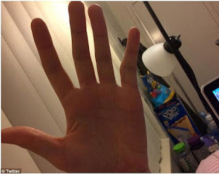 Smartphone pinky syndrome , the thing that smartphone users should ...