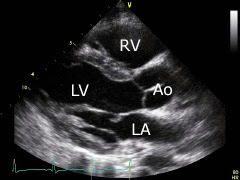 ER goldbook: Basic Echocardiography in ER