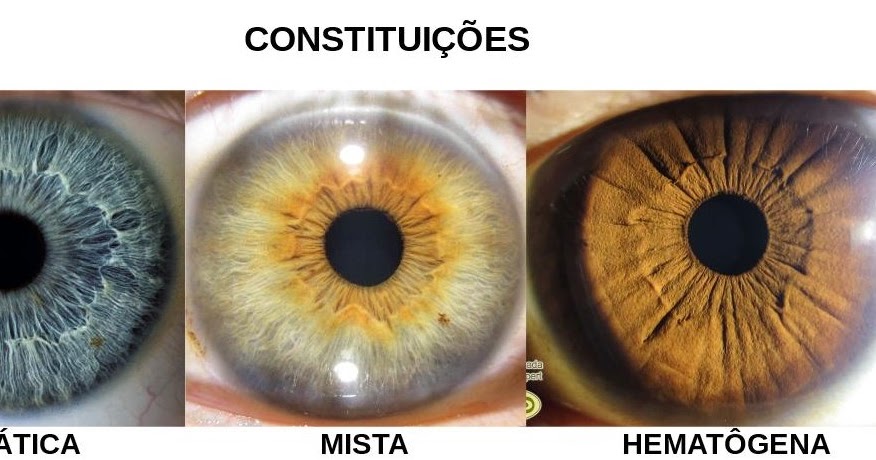 A COR DAS IRIS E SEU SIGNIFICADO (II)