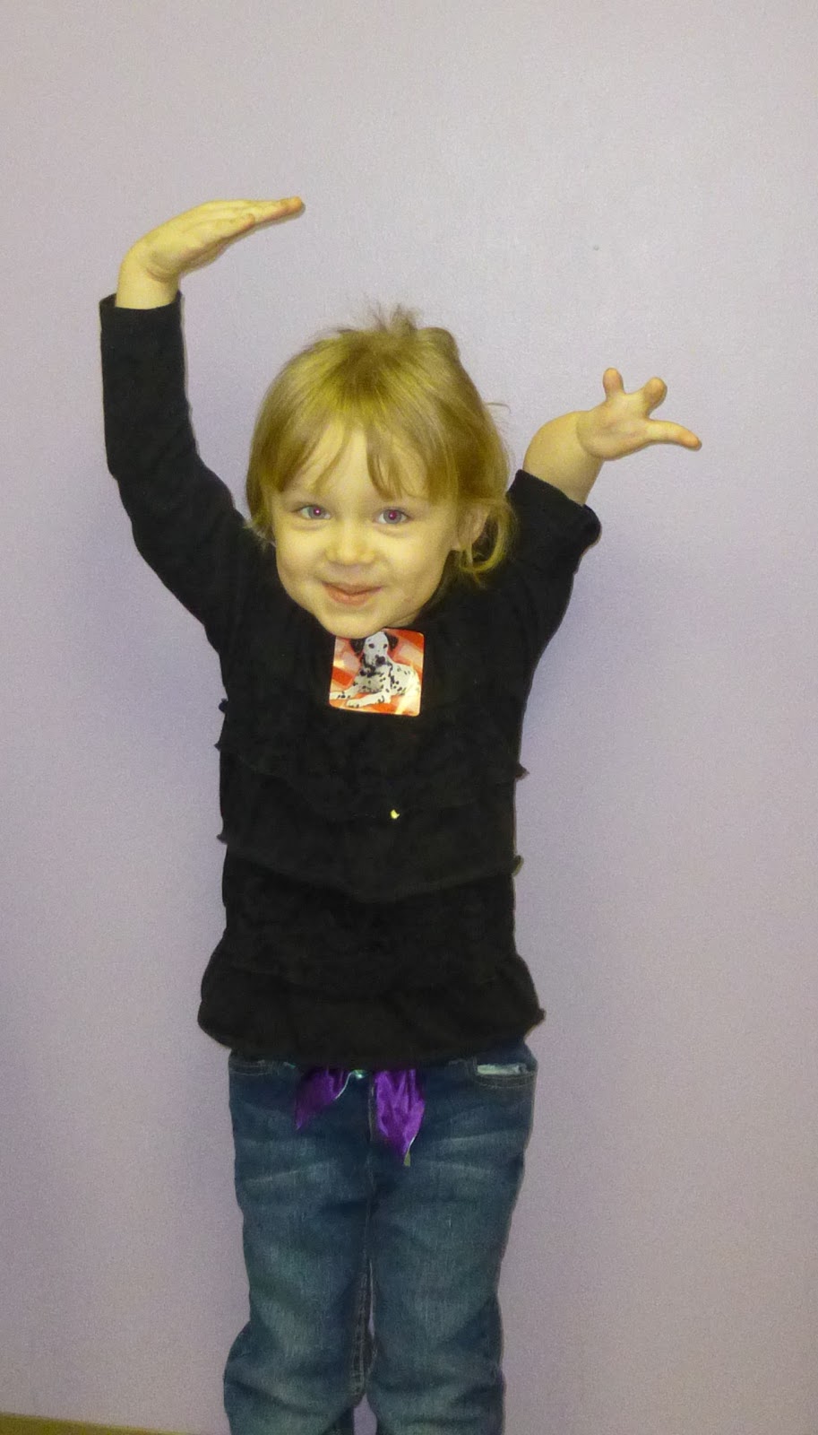 Ulnar deficiency, considerations for surgery | Congenital Hand and Arm ...