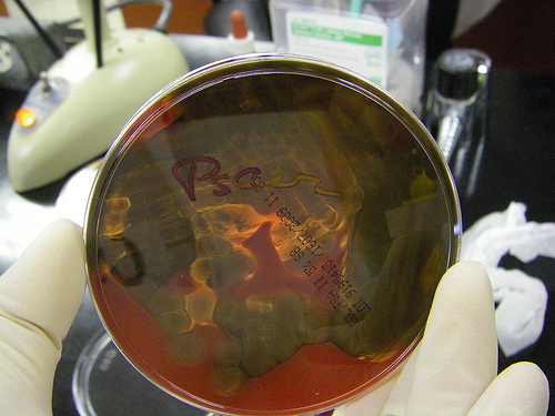 Infectious Disease Blog: Lab- Urines and CSF