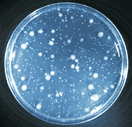 Tes Jurnal 5 (Tes Bakteri Total Metode Standard Plate Count) ~ Artikel ...