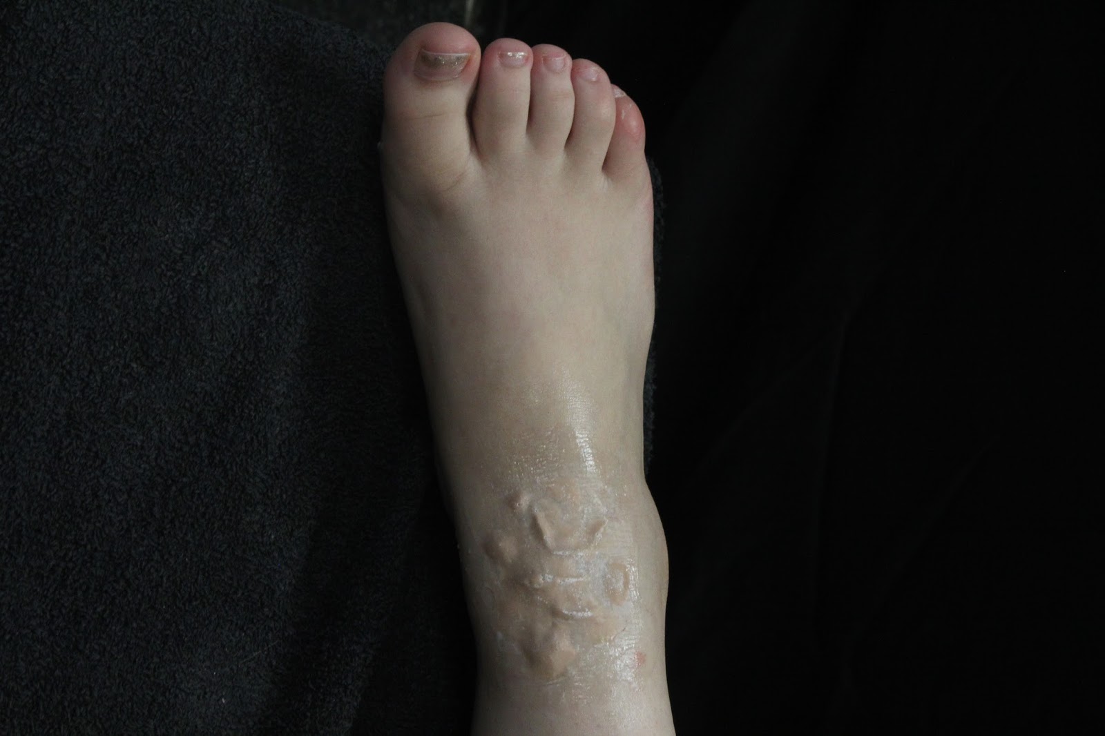 Make-up for Special Effects Unit: Brave New World: Snake Bite Wound ...