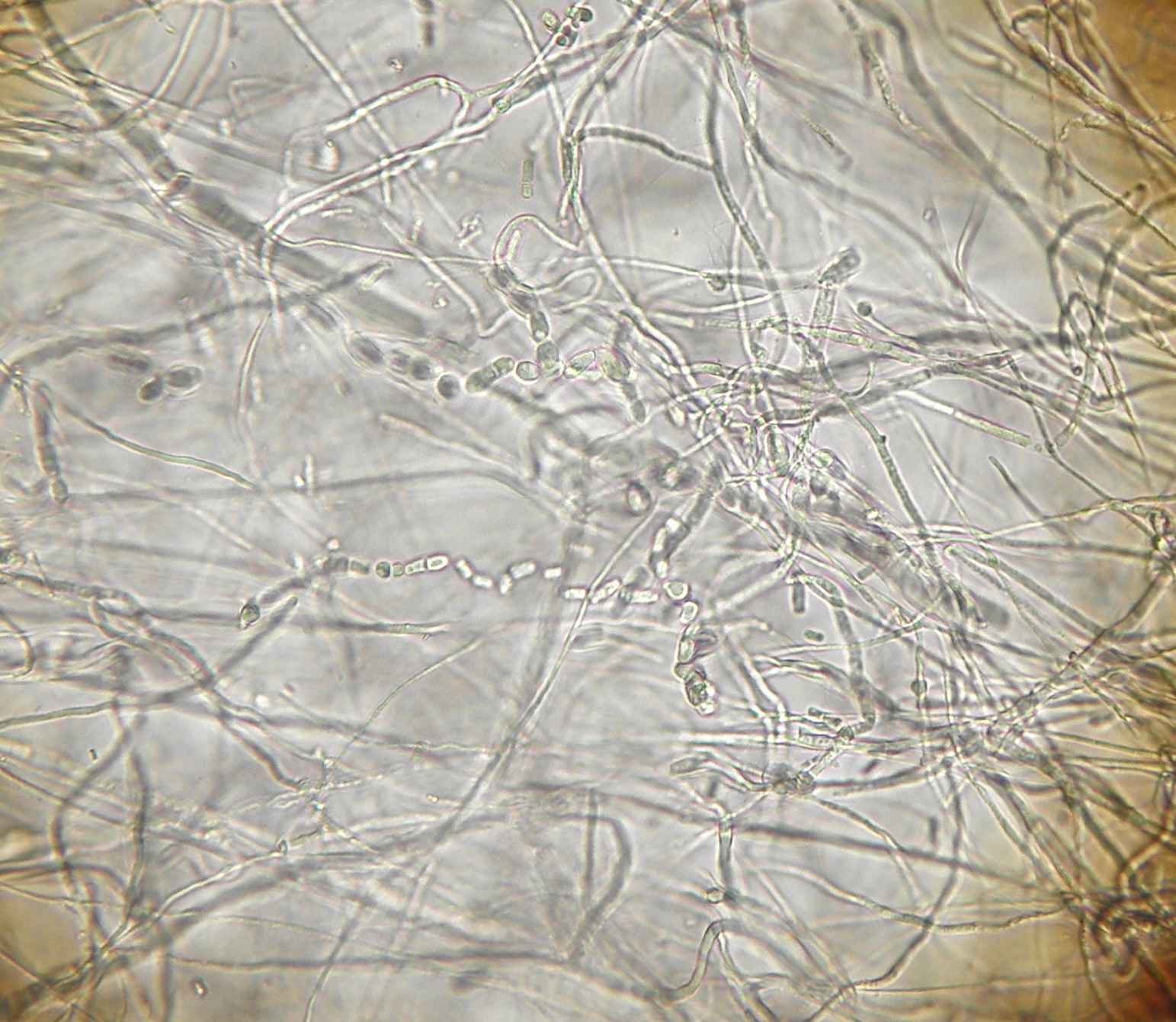 ATLAS MICOLOGIA: SCYTALIDIUM DIMIDIATUM (Neoscytalidium dimidiatum)