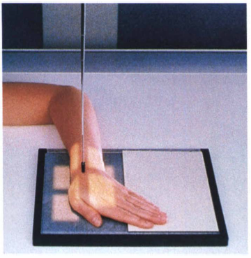 SCAPHOID X-RAY | ULNAR DEVIATION | Radiology Basics | Radtechonduty