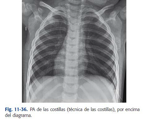 PRODUCCION Y TRATAMIENTO DE IMAGENES DIAGNOSTICAS: CAPITULO TÓRAX OSEO ...