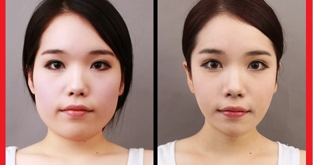 How To Shrink Naturally chubby Cheek - zona blog