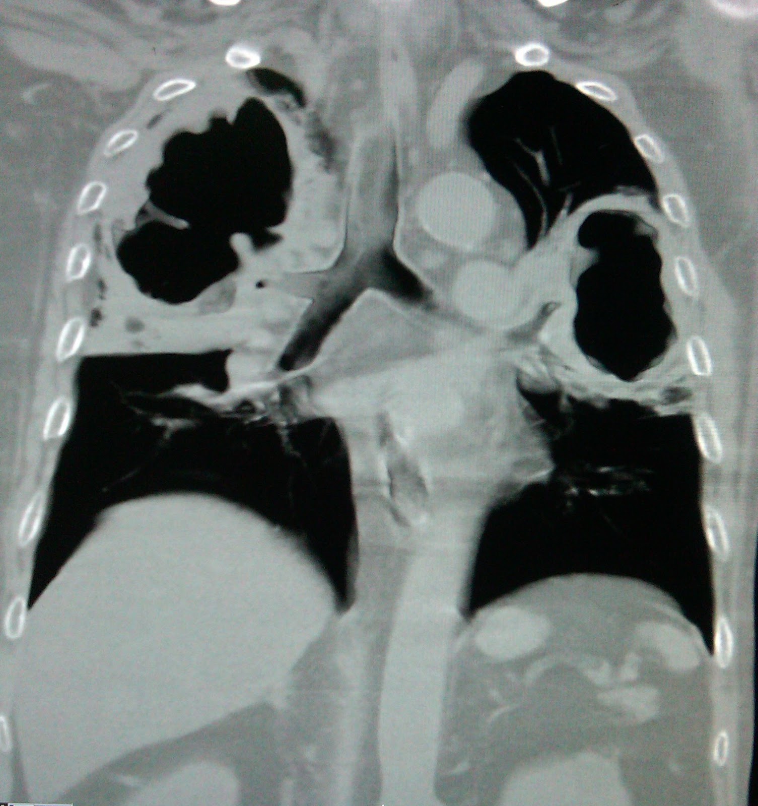 Rachmi Radiologi Solo : Februari 2013