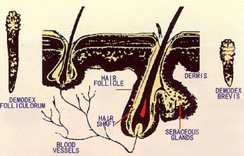 Parasitophilia: Demodex folliculorum