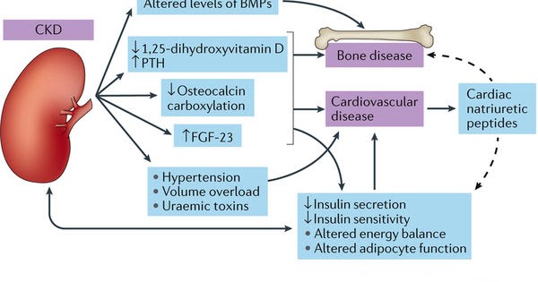 Life Expectancy of Stage 3 Chronic Kidney Disease (CKD)