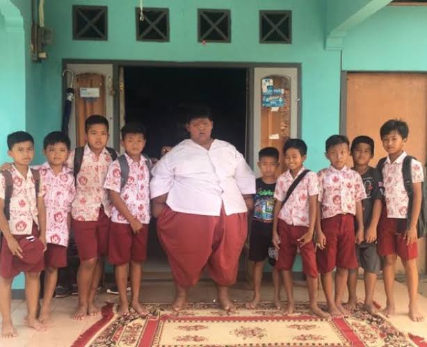 Incredible Story Of The Fattest Kid In The World Who Lost 105 kg