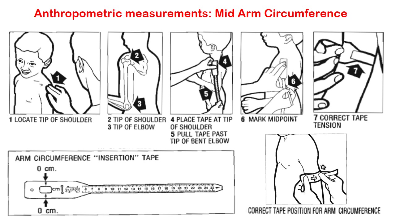 The Family physician : Anthropometric assessments