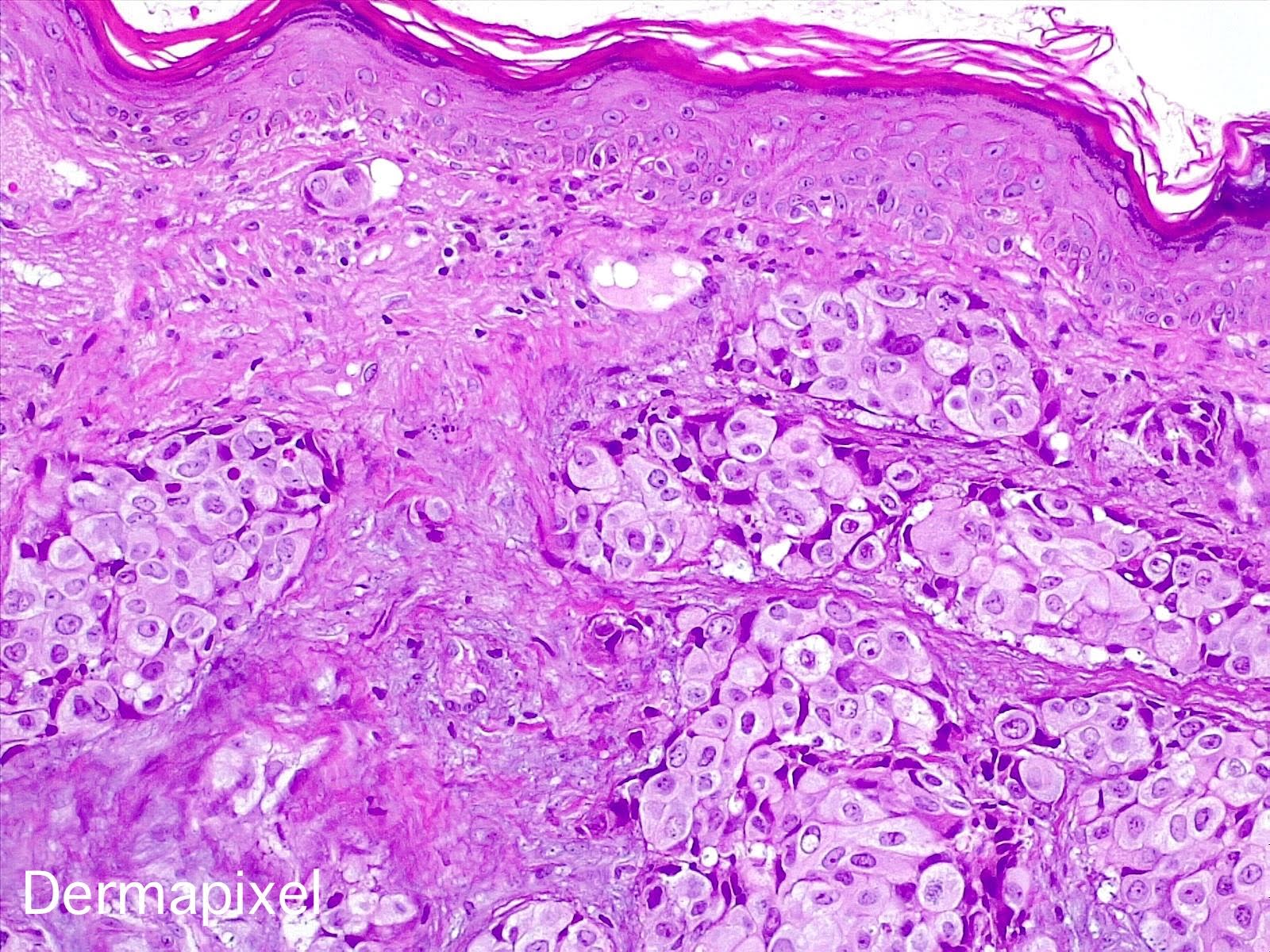 Dermapixel: febrero 2021