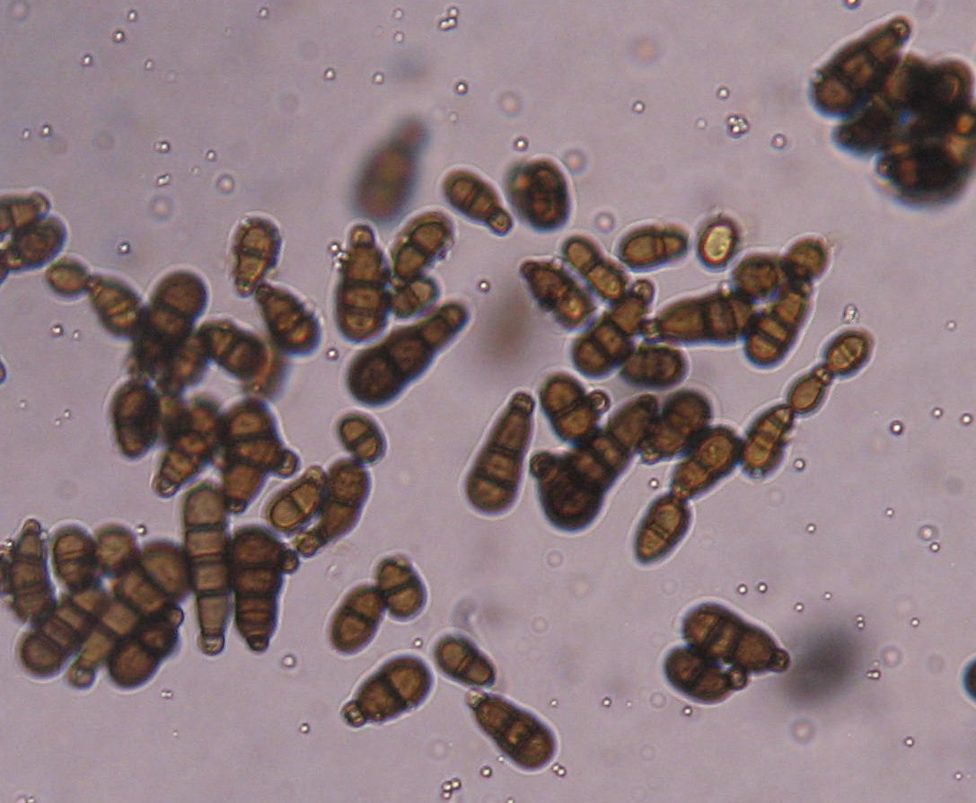 TAMU_PLPA631_FungalBlog_LornaNissen: Lab 6