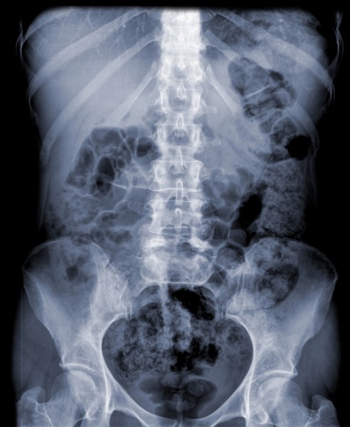 MEZZI DIAGNOSTICI DEL COLON-RETTO | Tozande